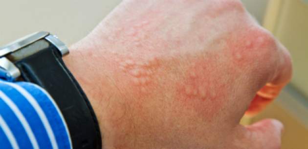 Sú minerálne oleje škodlivé? - ZDRAVIE.sk