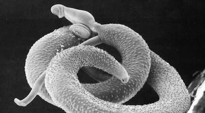 Ľudské parazity - Ľudské parazity (1 / 14) - Galéria - ZDRAVIE.sk