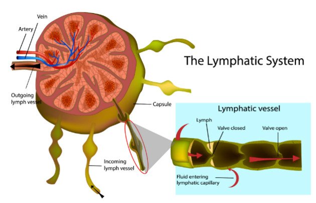Non - Hodgkinov lymfóm - ZDRAVIE.sk