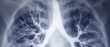 Bronchoskopia - ZDRAVIE.sk