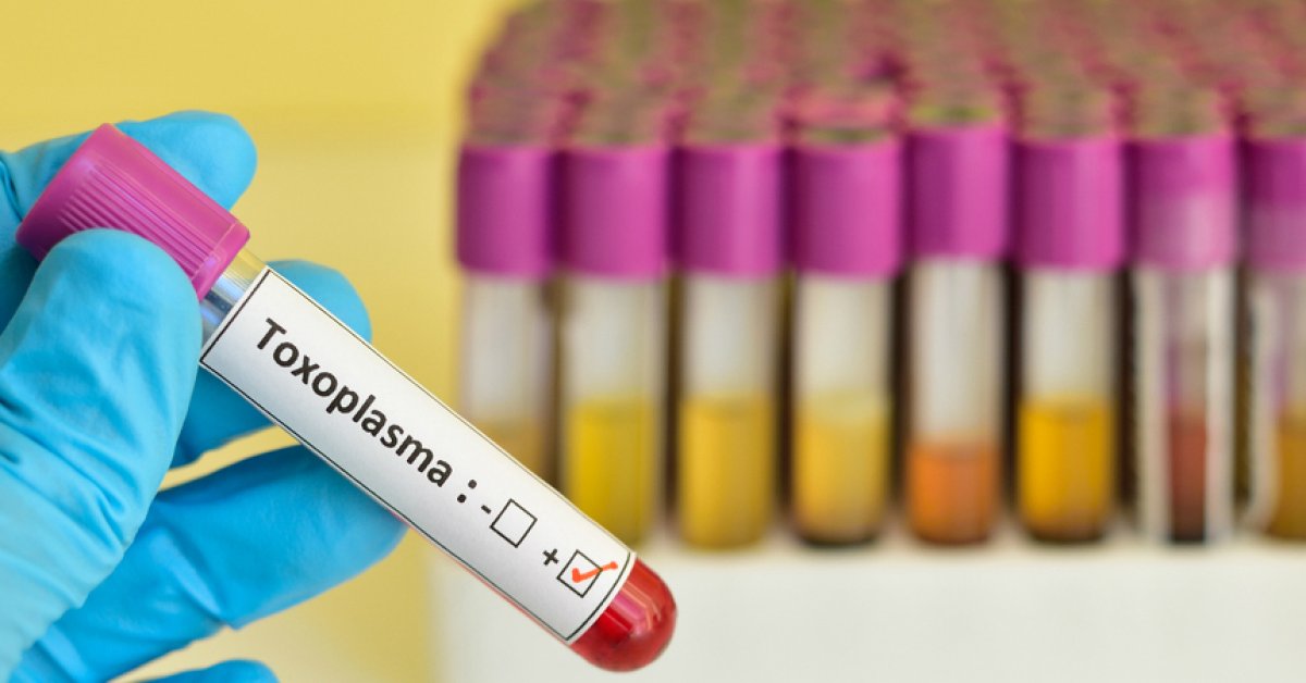 Toxoplazmóza - ZDRAVIE.sk