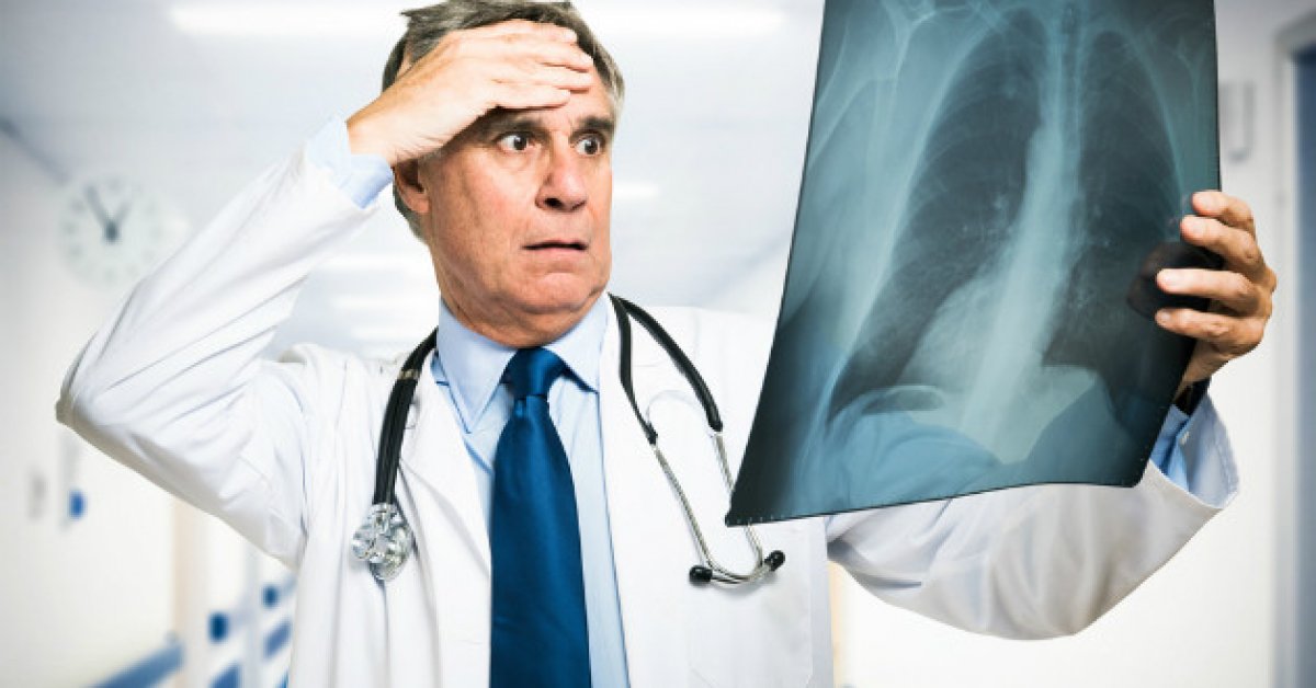 Skryté príčiny rakoviny: 2. časť - ZDRAVIE.sk