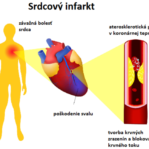 Srdce - Srdce - poloha v tele (4 / 5) - Galéria - ZDRAVIE.sk